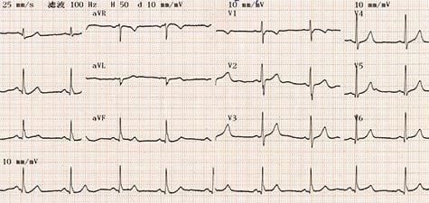 MDVIP Guide to Testosterone | MDVIP